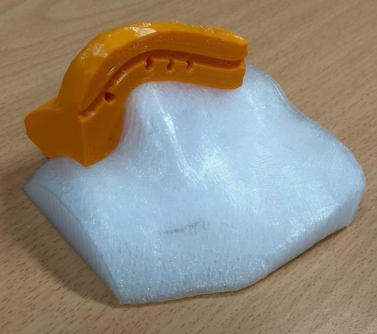 Brachytherapy – Medical Physics